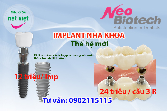 Implant Neo BioTech – Korea « Nha khoa Thẩm mỹ Nét Việt
